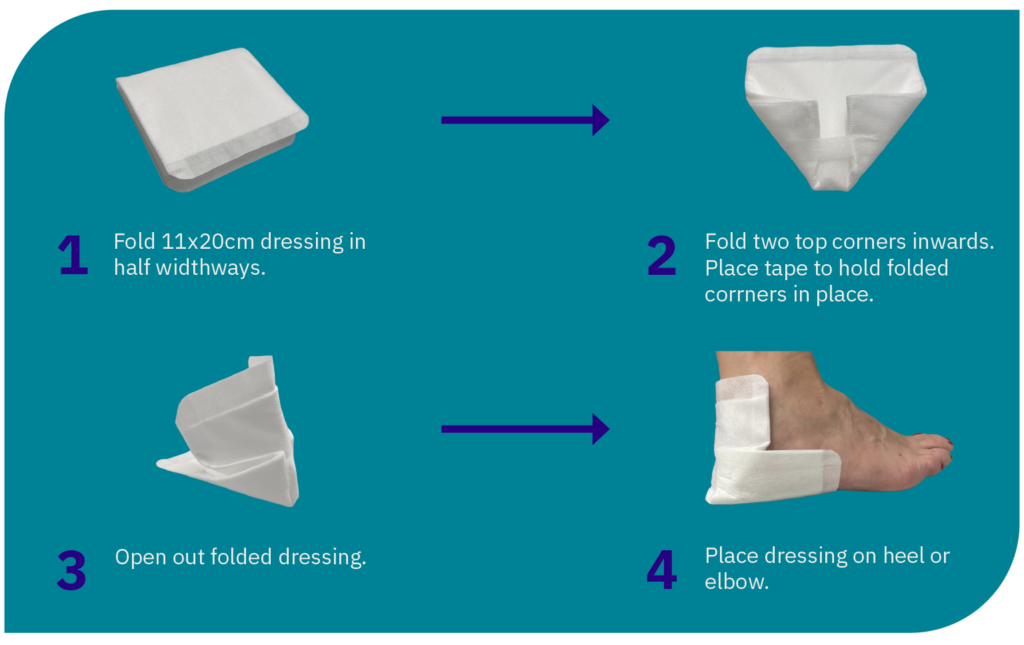 A folding guide for wound dressings | Wound management