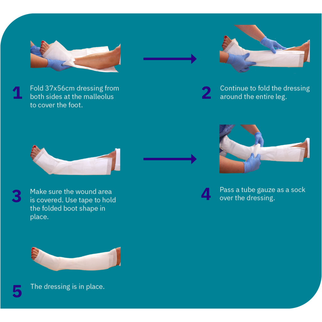 A folding guide for wound dressings | Wound management